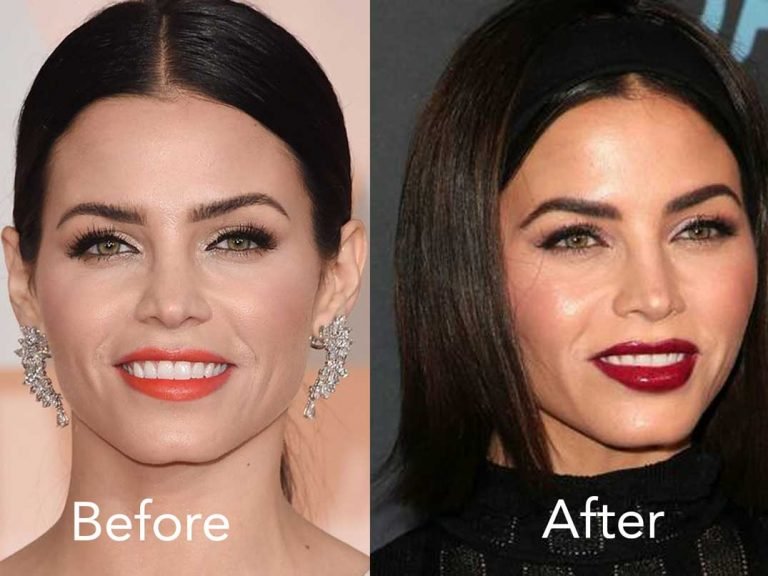 Are Chin Dimples an Attractive feature - My Beauty Consultant