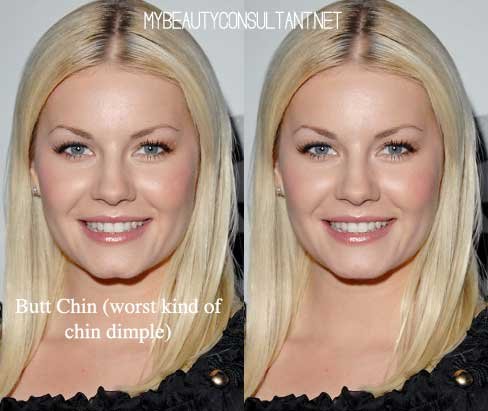 Are Chin Dimples an Attractive feature - My Beauty Consultant